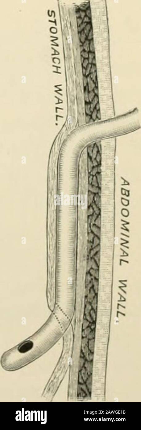 Operative surgery . Fig. 947.. :V Fig. 948. Fig. 949. Fig. 950. Fig ...