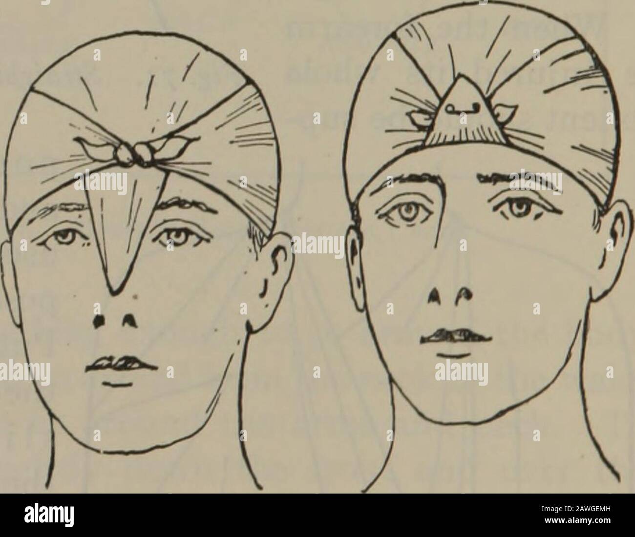Practical nursing : a text-book for nurses . Fig- 73- Sling inner end ...