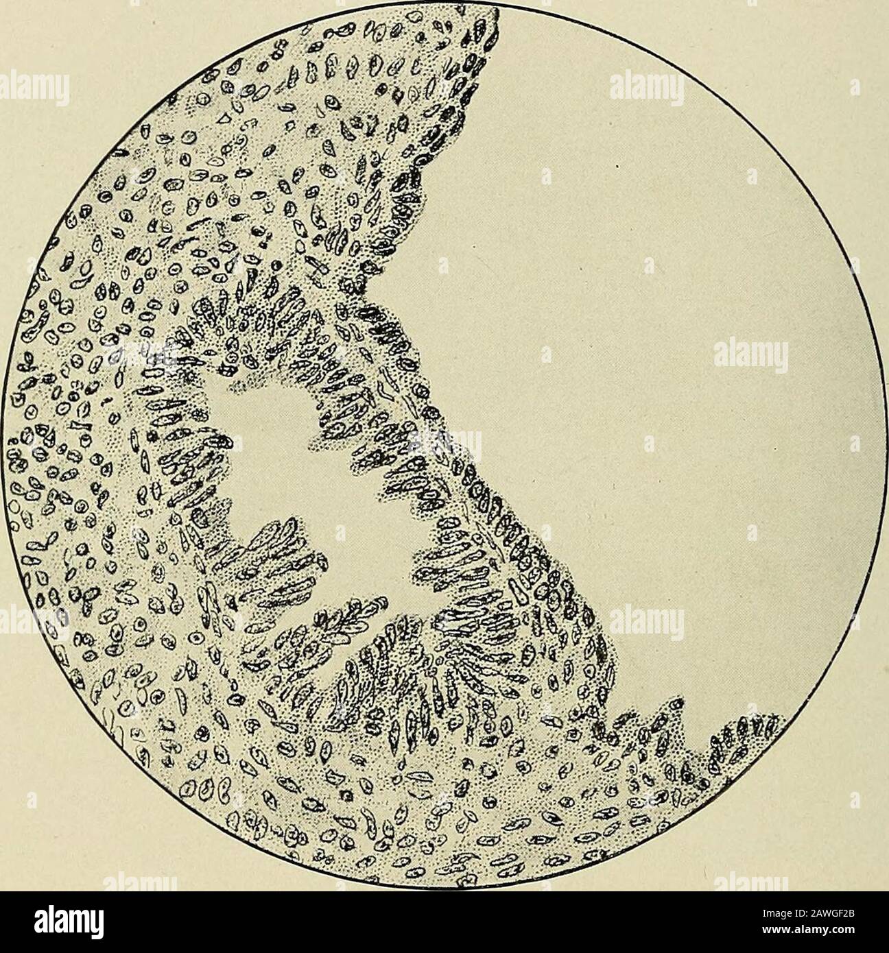 Peritoneal cavity hi-res stock photography and images - Alamy