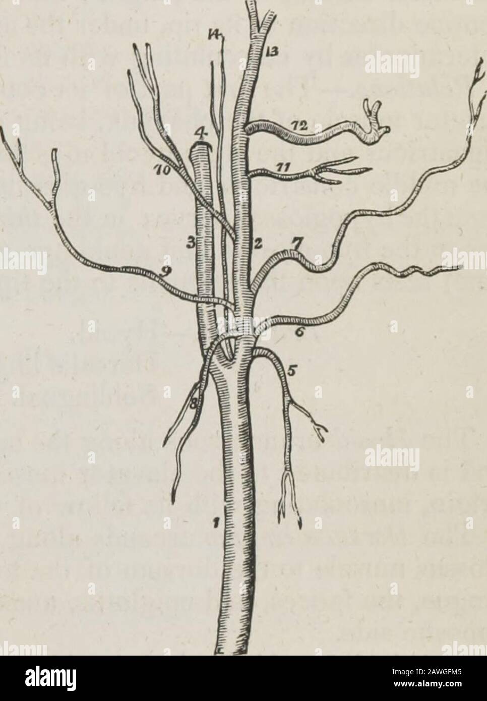 A system of human anatomy, general and special . inferiorthyroid ...