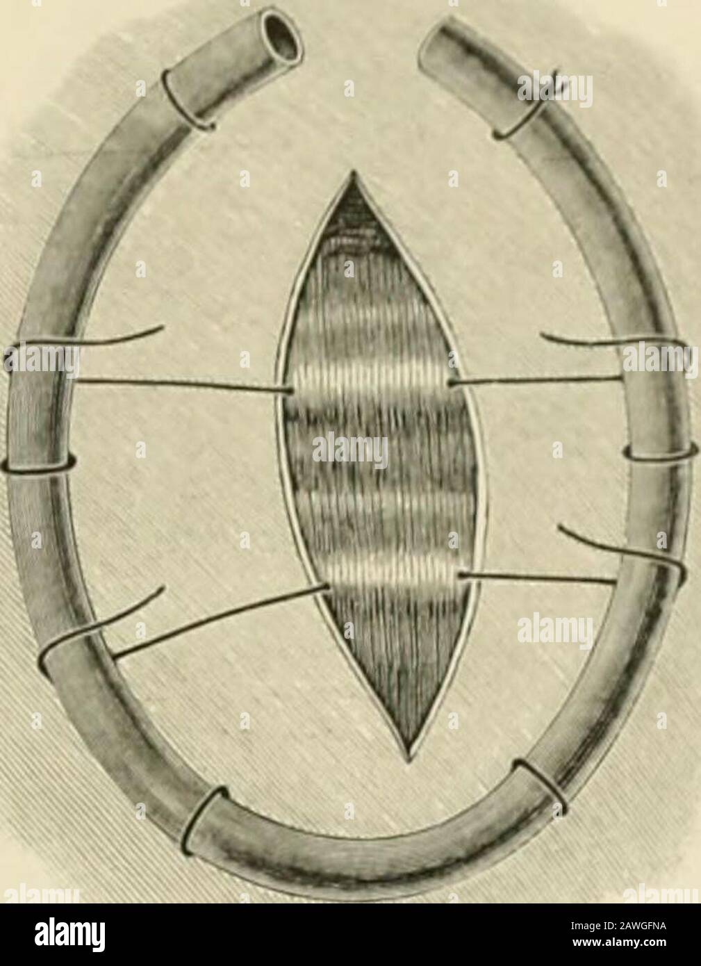 Half inch border hi-res stock photography and images - Alamy