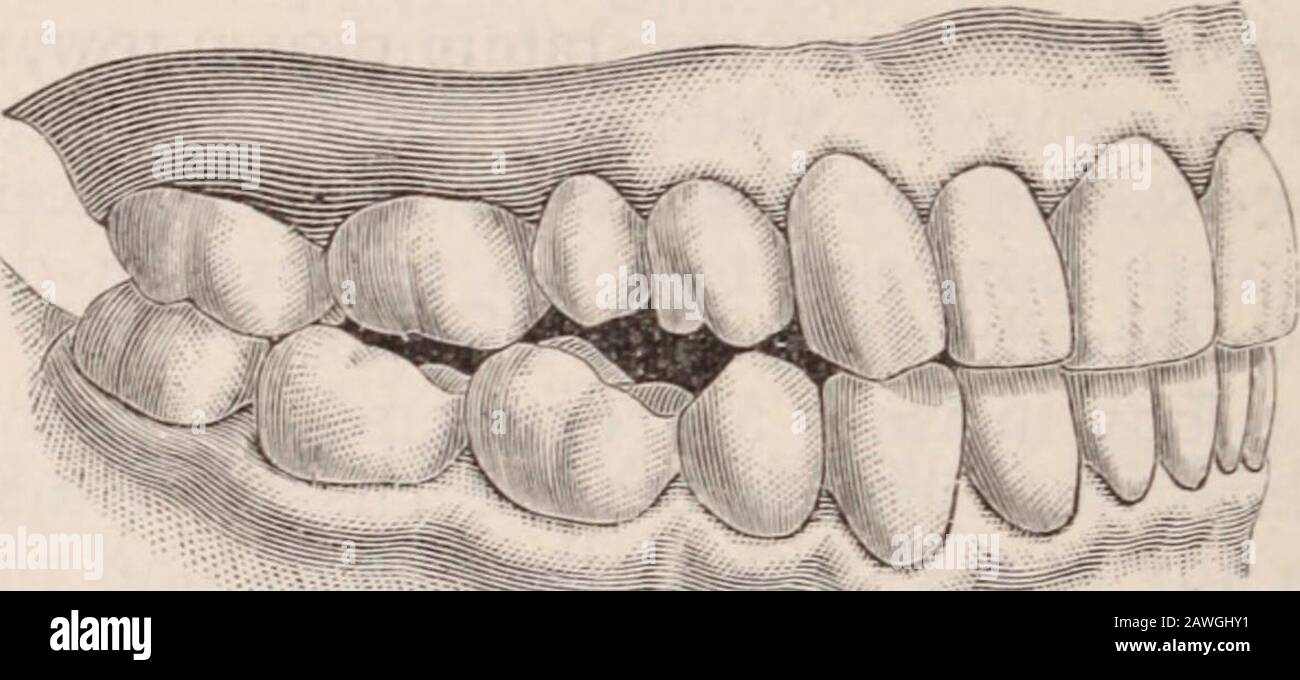 Cuspids hi-res stock photography and images - Alamy