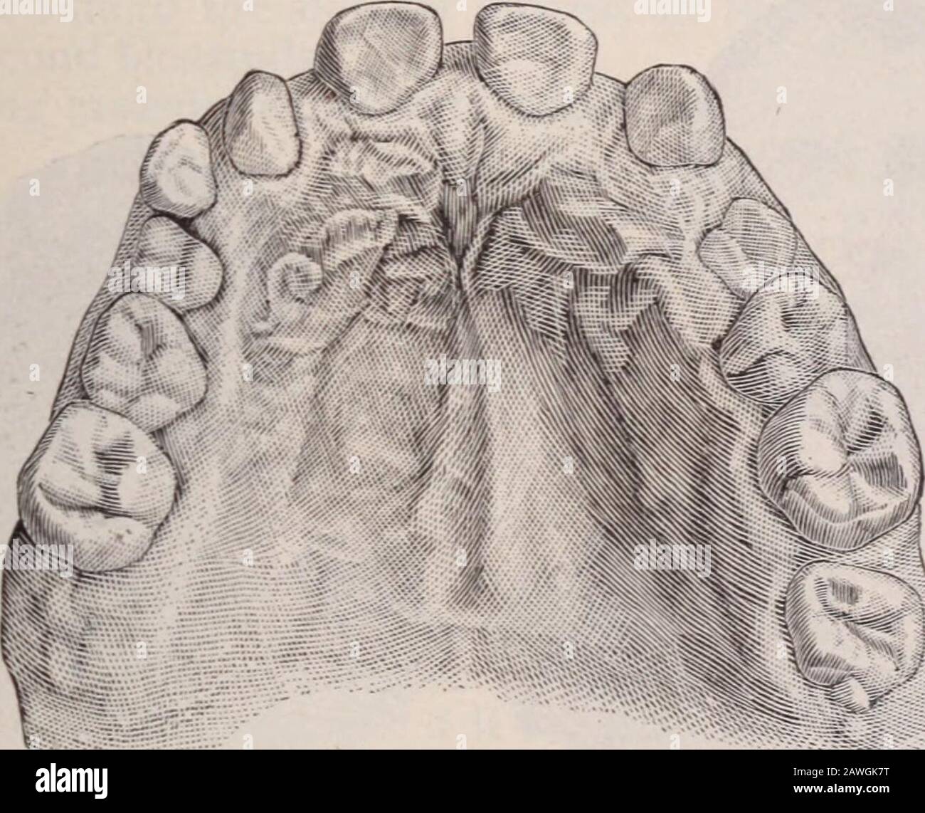 Alveolar process hi-res stock photography and images - Alamy