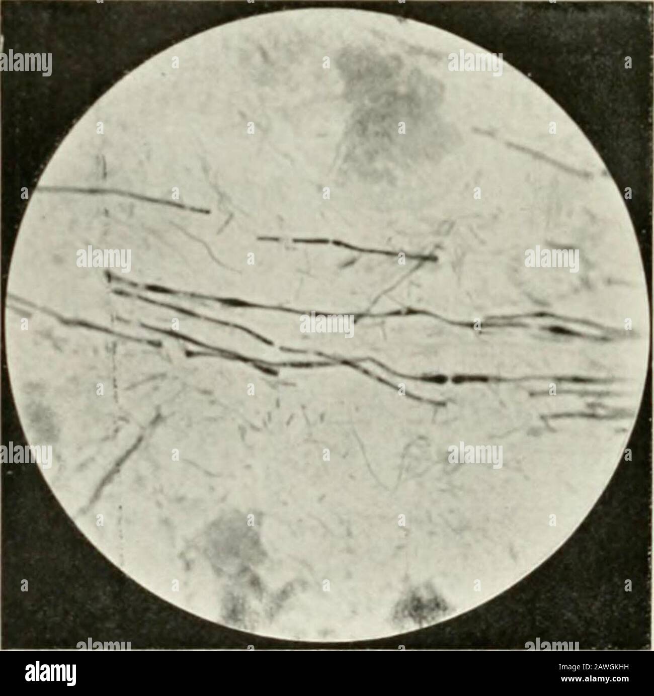 Broken filaments hi-res stock photography and images - Alamy