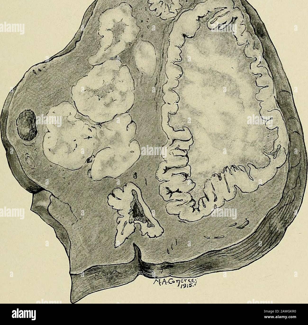 Atretic follicles hi-res stock photography and images - Alamy