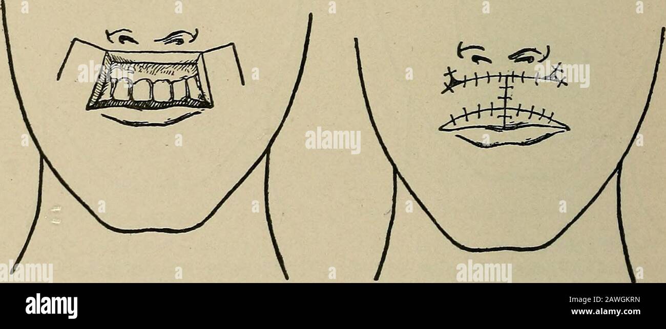 Square upper lip hi-res stock photography and images - Alamy