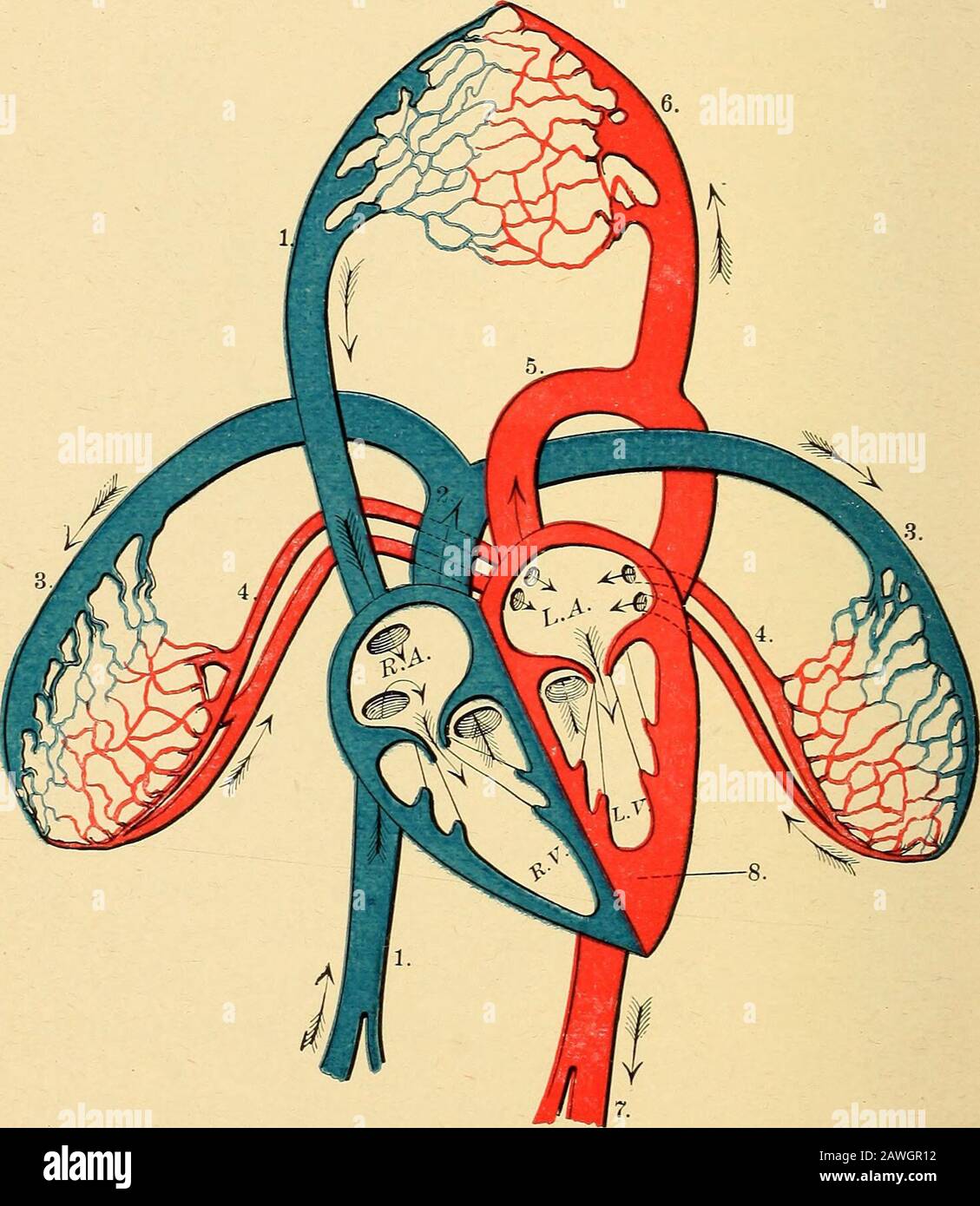 Arteries obstruction hi-res stock photography and images - Alamy