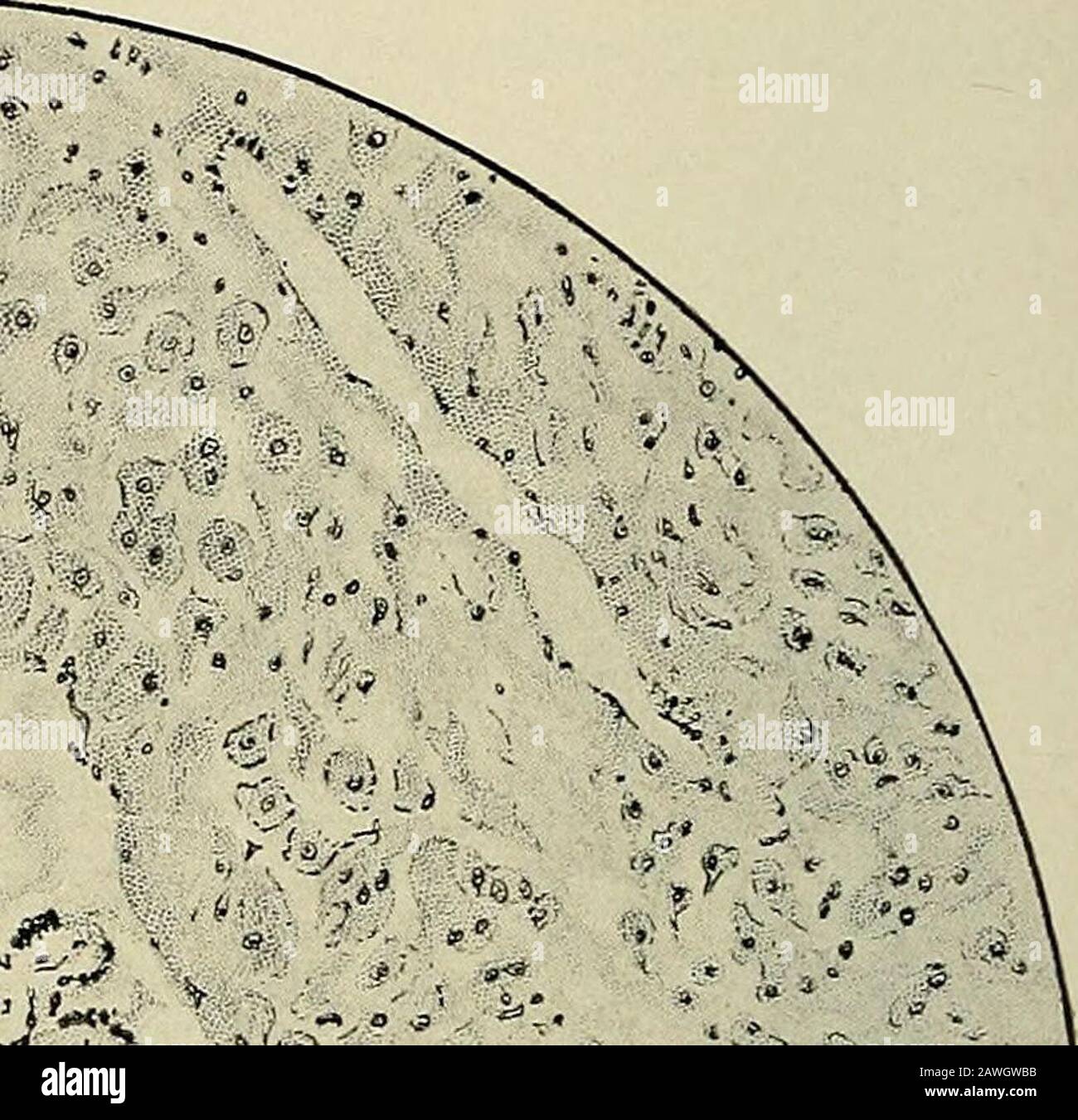 Chorionic villi hi-res stock photography and images - Alamy