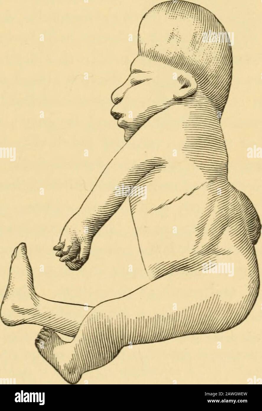 Philadelphia mutter museum hi-res stock photography and images - Alamy