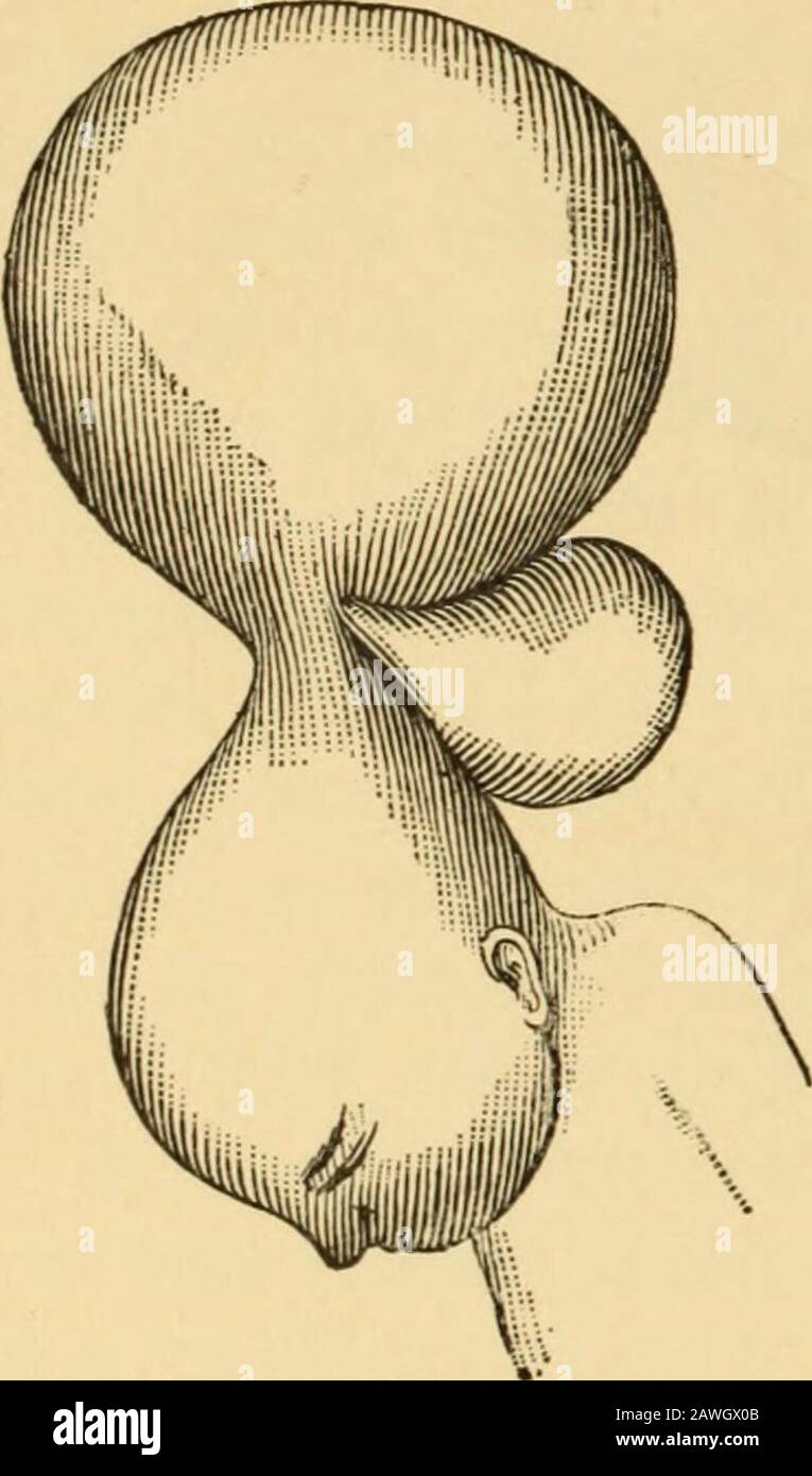 Podalic hi-res stock photography and images - Alamy