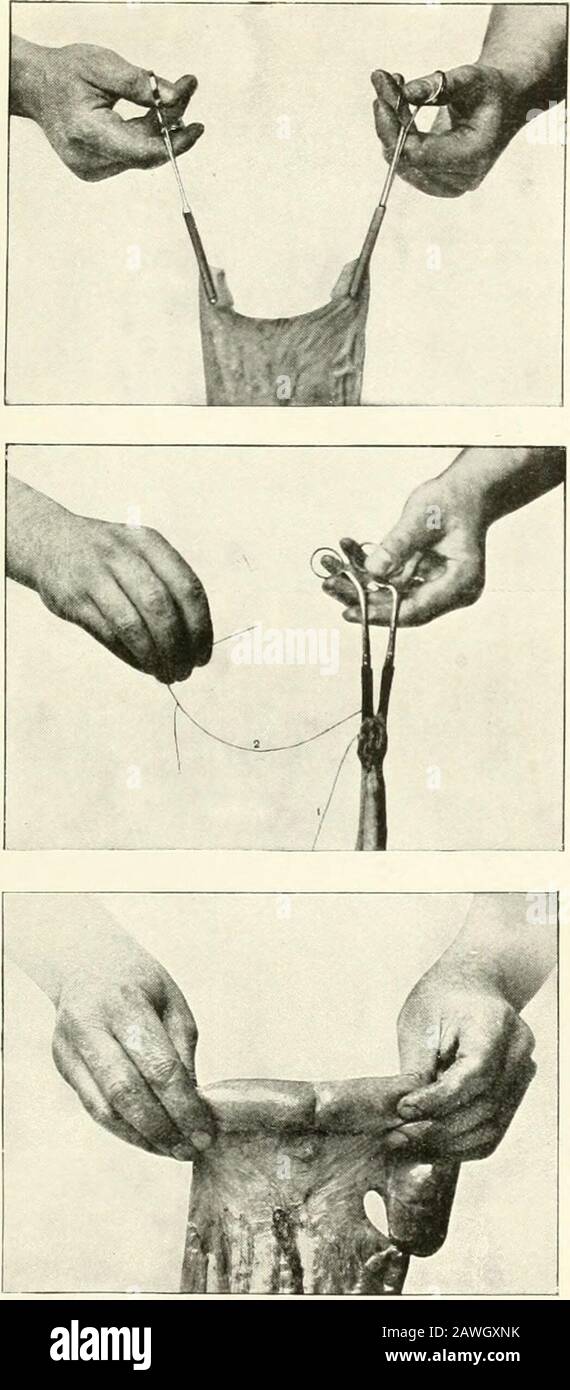 The Practitioner . scribed upderpermanent enterostomy; and a tube put ...