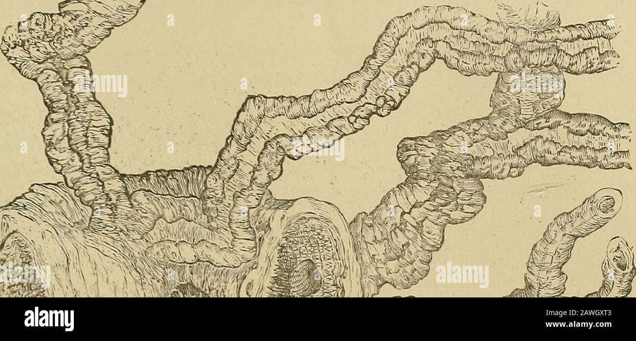 Kidney diseases, urinary deposits, and calculous disorders : their ...