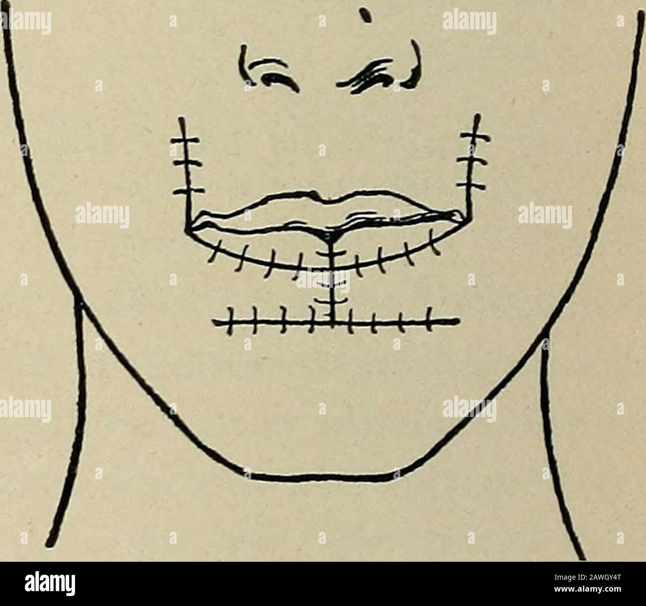 Free border of lip hi-res stock photography and images - Alamy