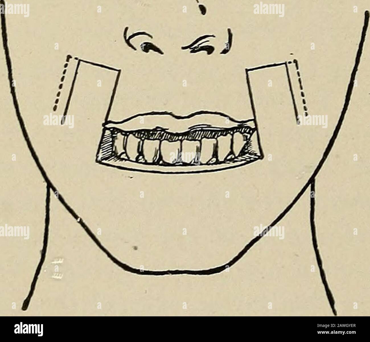 Operative surgery, for students and practitioners . ^ cut long, are ...