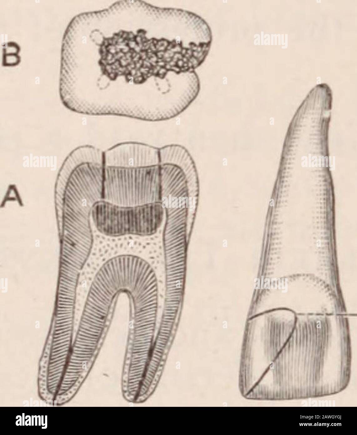 Apical Foramen