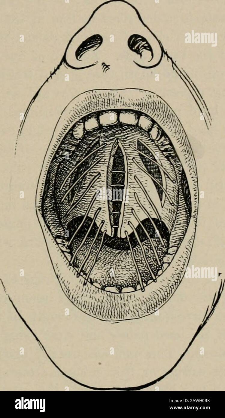 Operative surgery, for students and practitioners . ocess. This process ...