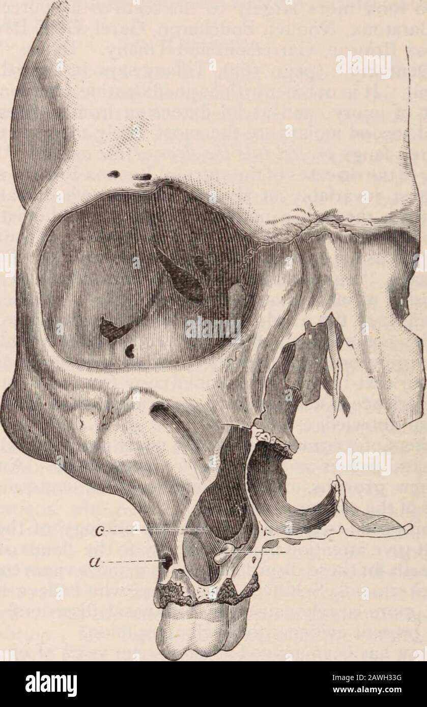 Conical Protrusion High Resolution Stock Photography and Images - Alamy
