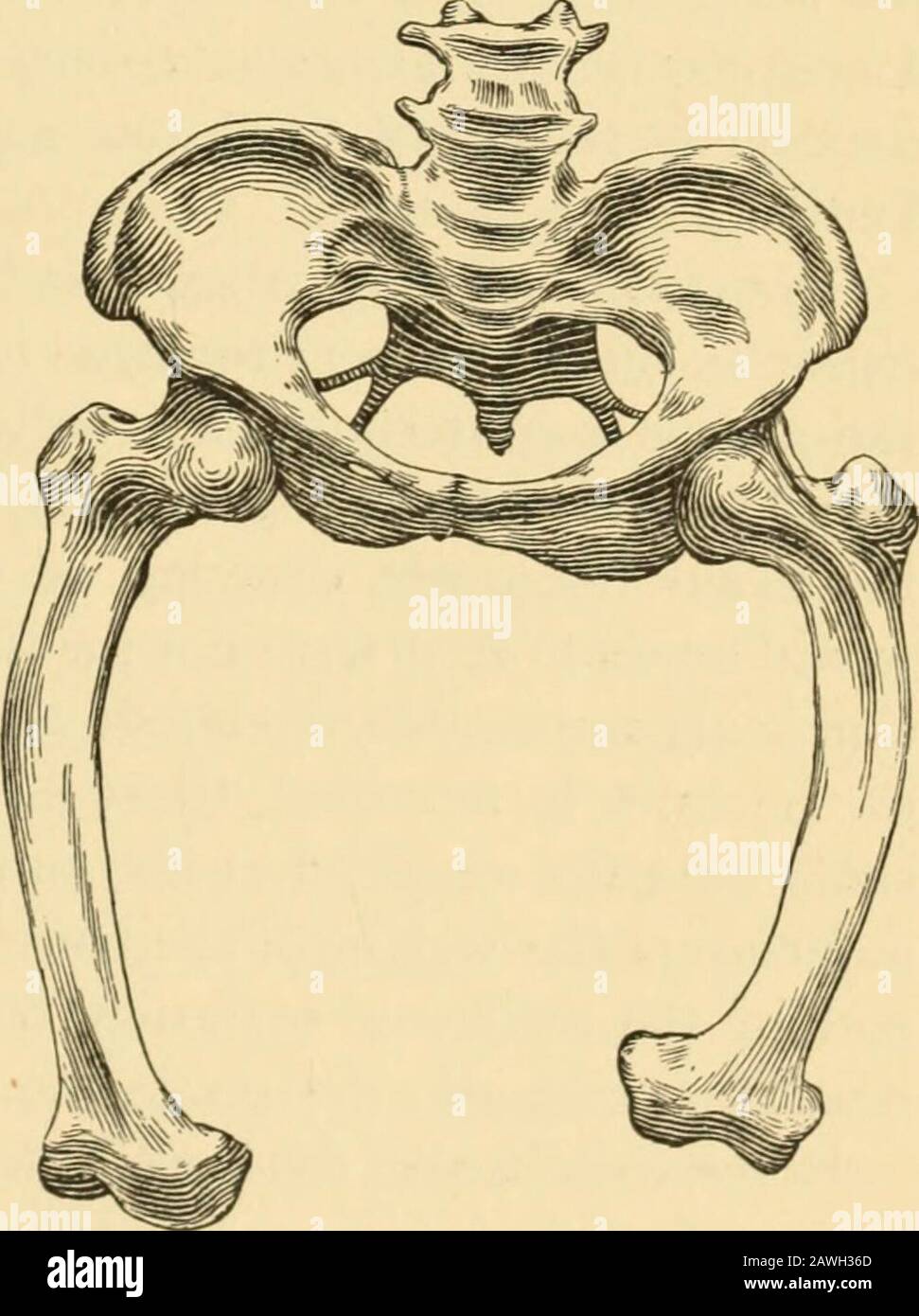 Rachitic hi-res stock photography and images - Alamy