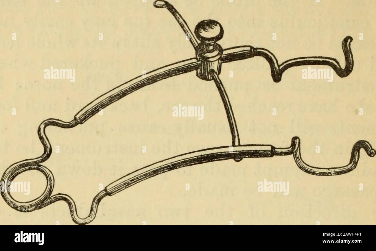 Exposed tendon hi-res stock photography and images - Alamy