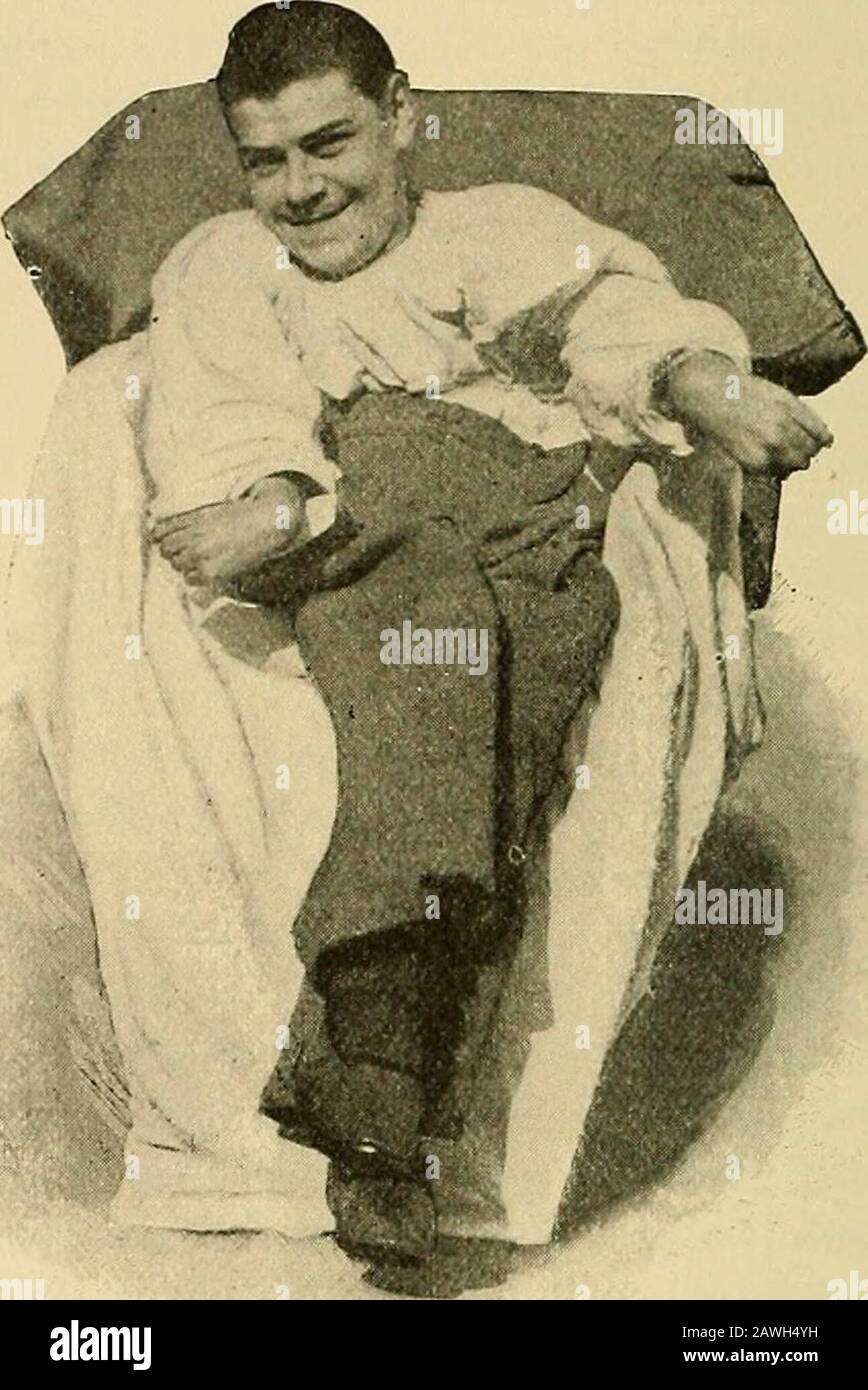 Diplegic cerebral palsy hi-res stock photography and images - Alamy