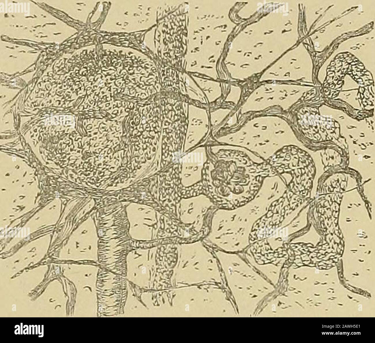 Kidney diseases, urinary deposits, and calculous disorders : their ...