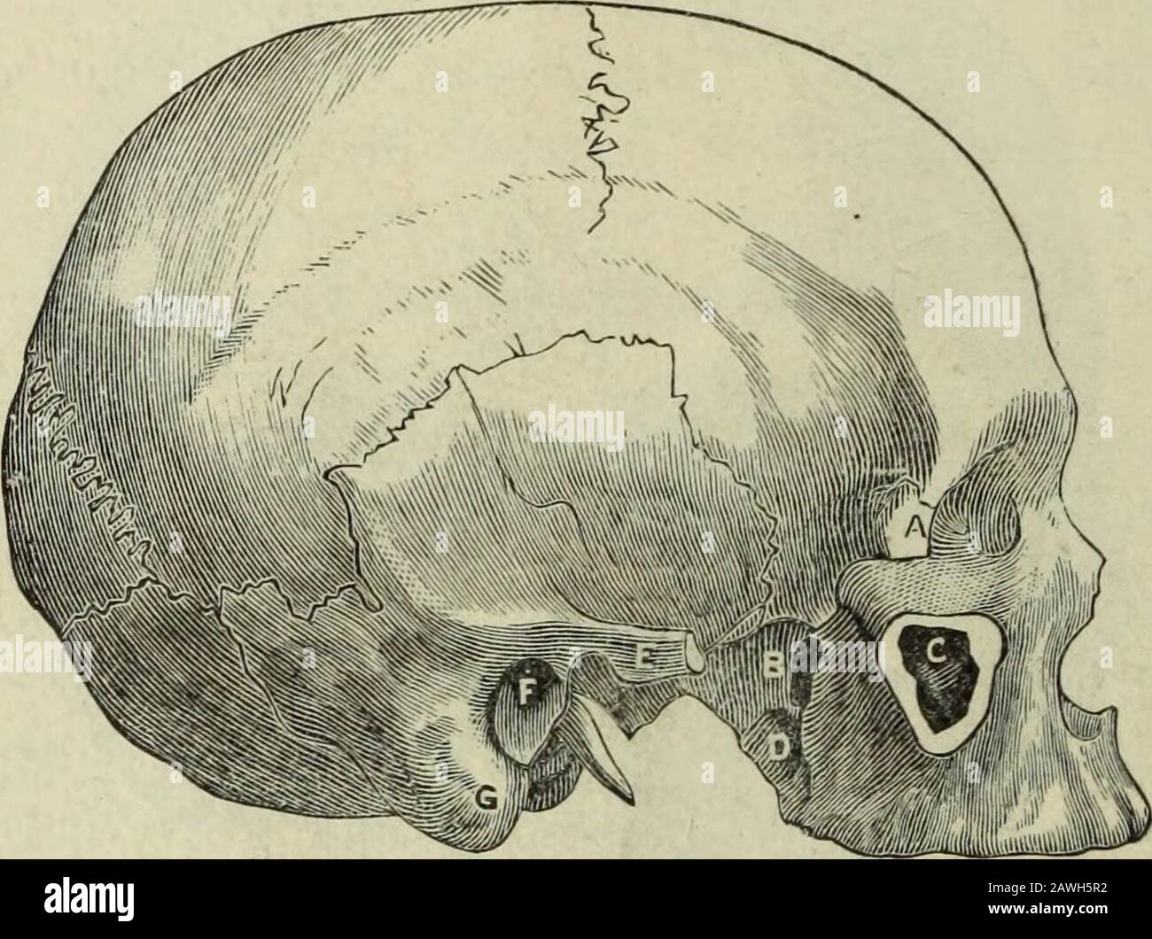 Thewalls hi-res stock photography and images - Alamy