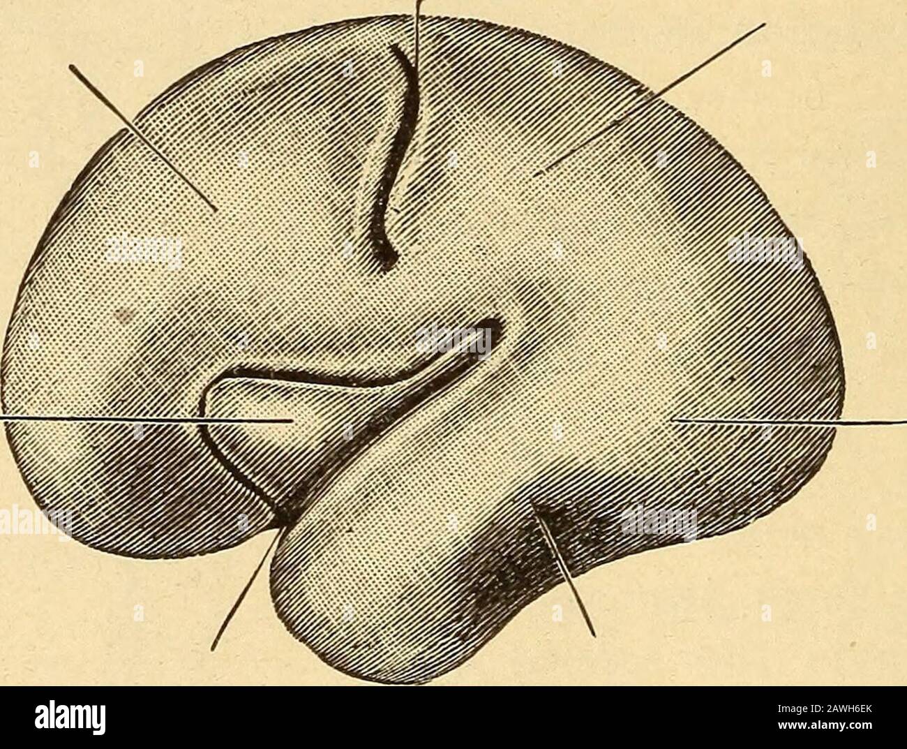 Diseases of the nervous system .. . ult man being partly obliterated ...
