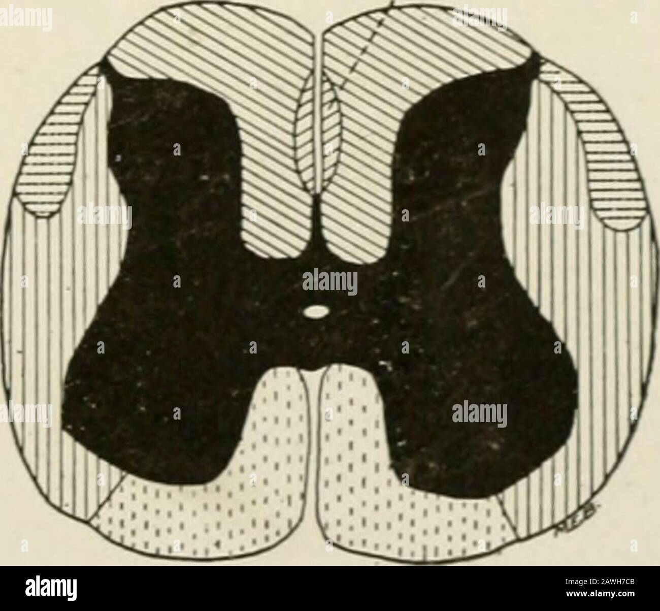 Tectospinal Tract Medulla