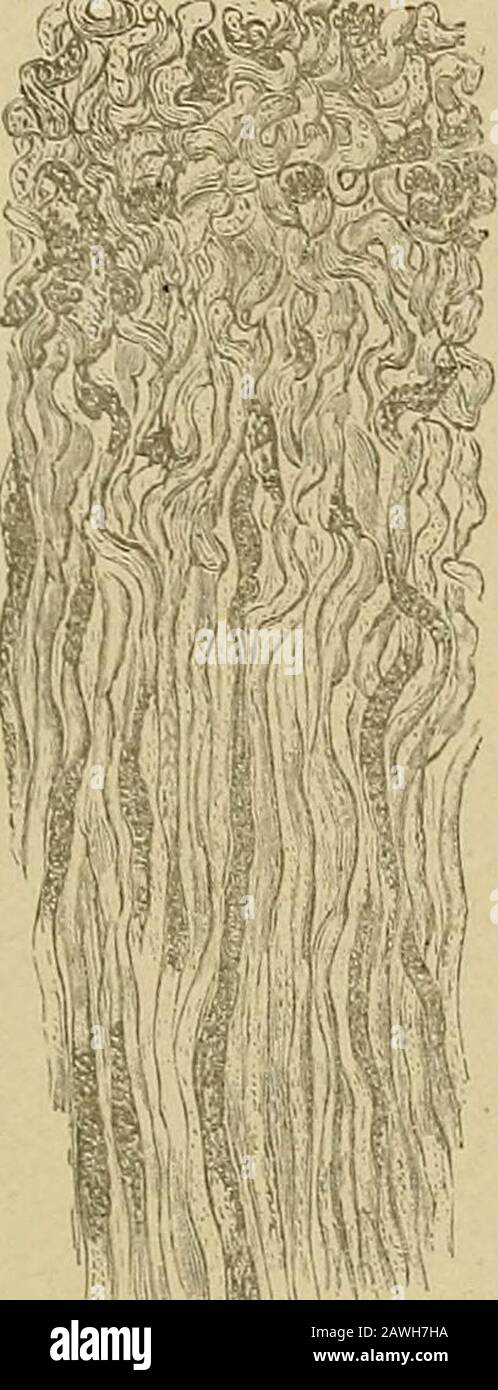 Kidney diseases, urinary deposits, and calculous disorders : their ...