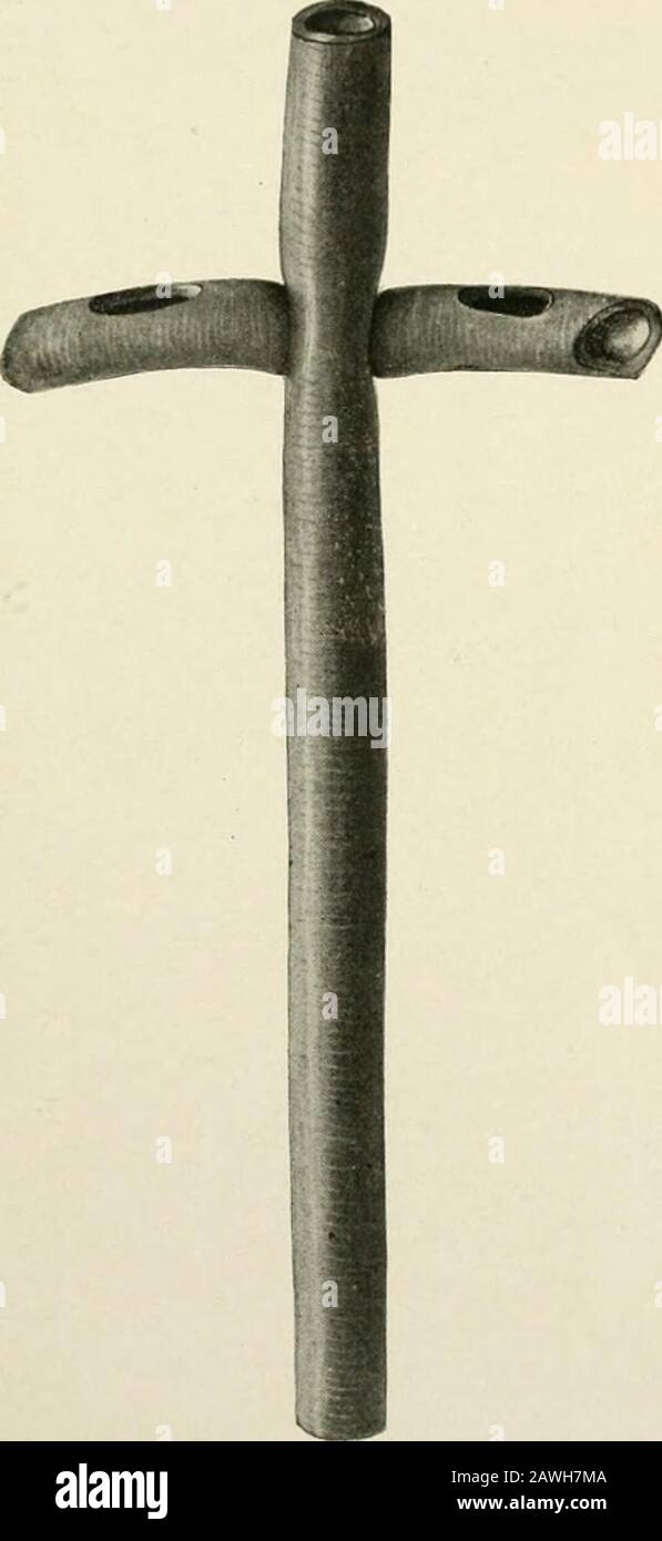 Acute salpingitis hi-res stock photography and images - Alamy