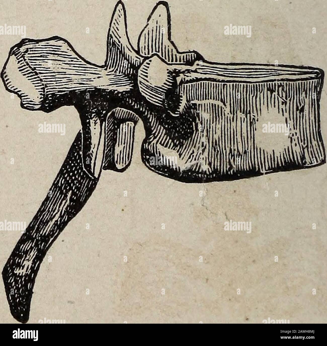 Irregular bones hi-res stock photography and images - Alamy