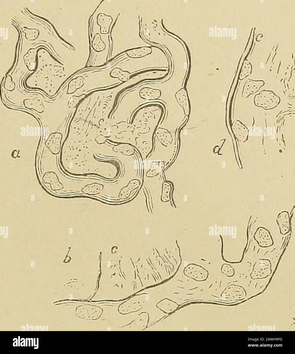 Capillary loop hi-res stock photography and images - Alamy