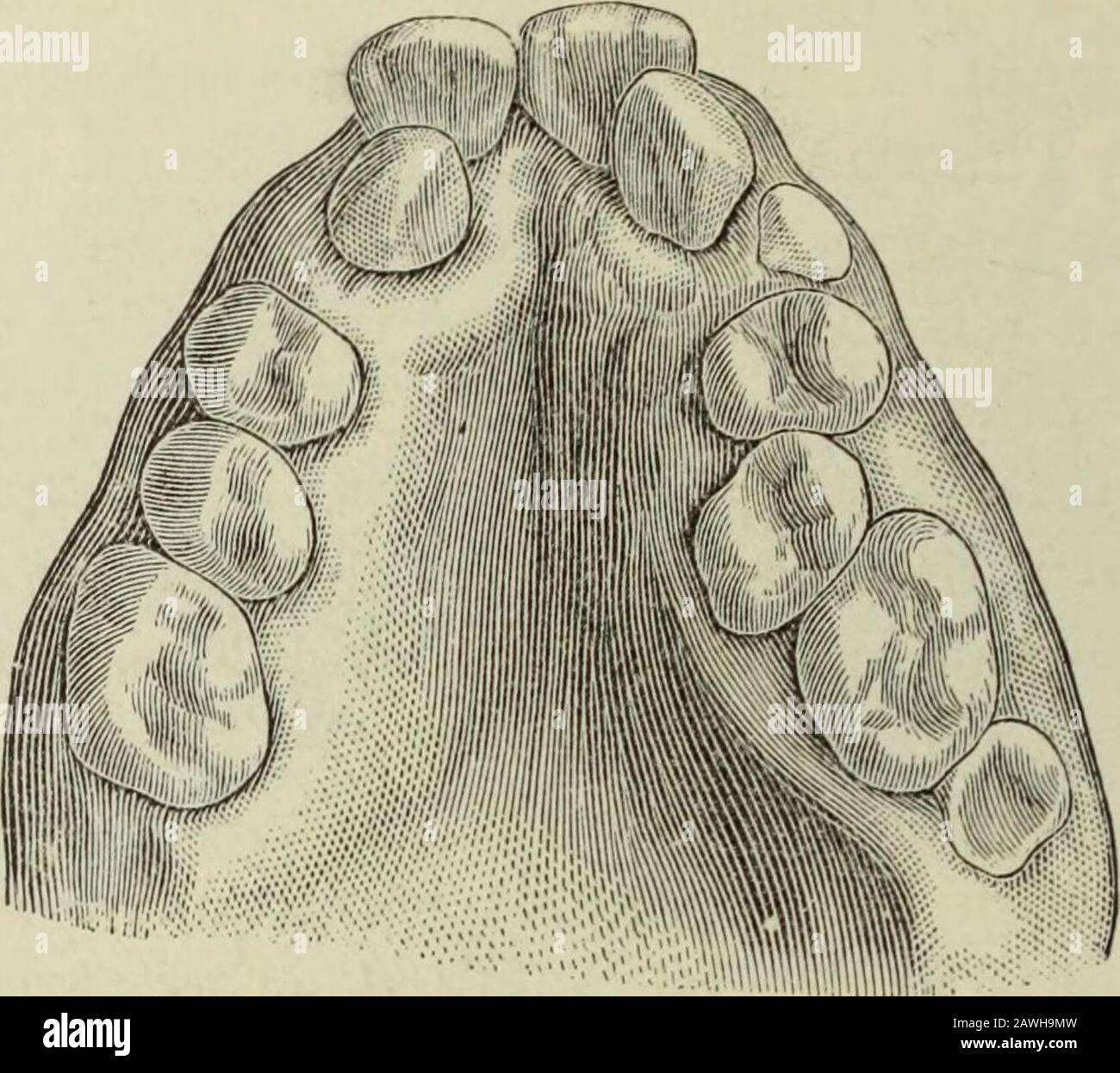 The Dental cosmos . tening in front and a broadening of the back part ...