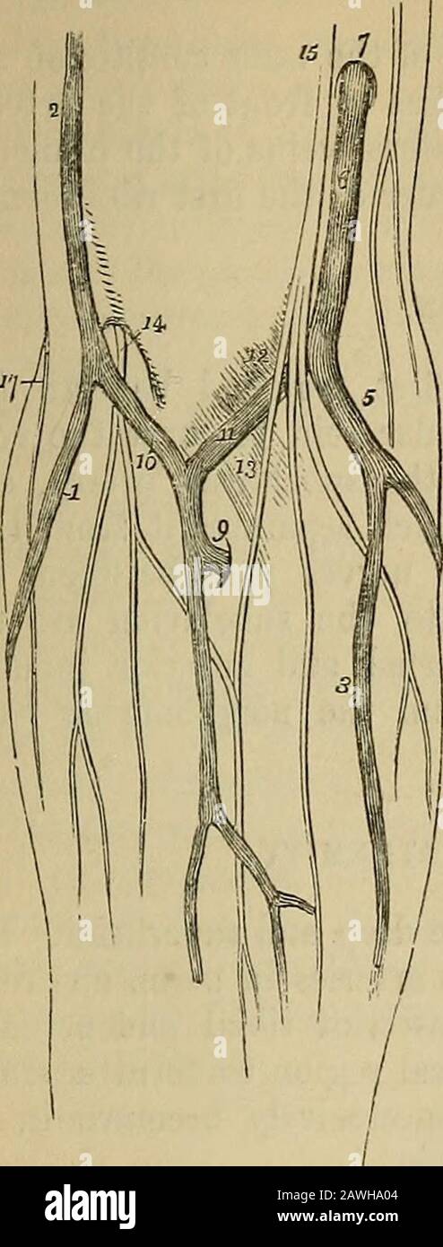 Cephalic vein hi-res stock photography and images - Alamy