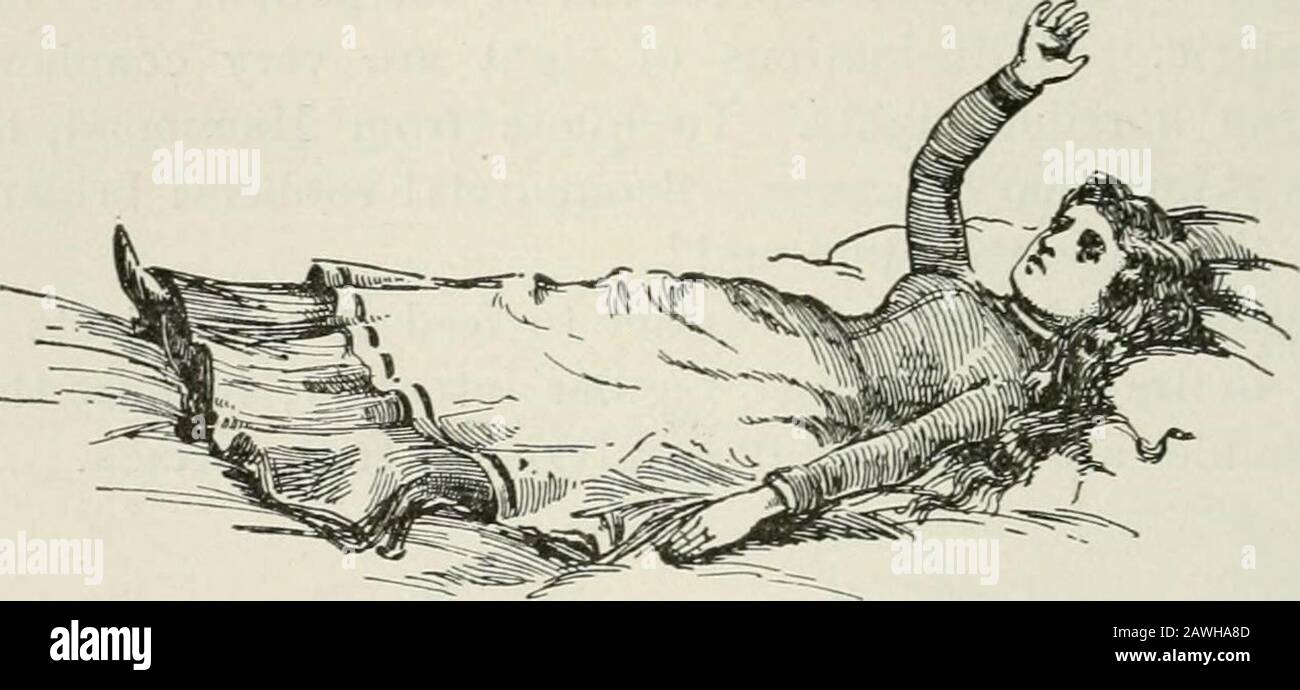 Catalepsy hi-res stock photography and images - Alamy