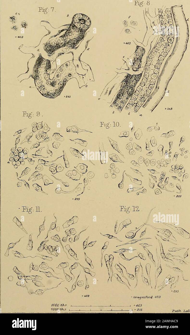 Kidney diseases, urinary deposits, and calculous disorders : their ...