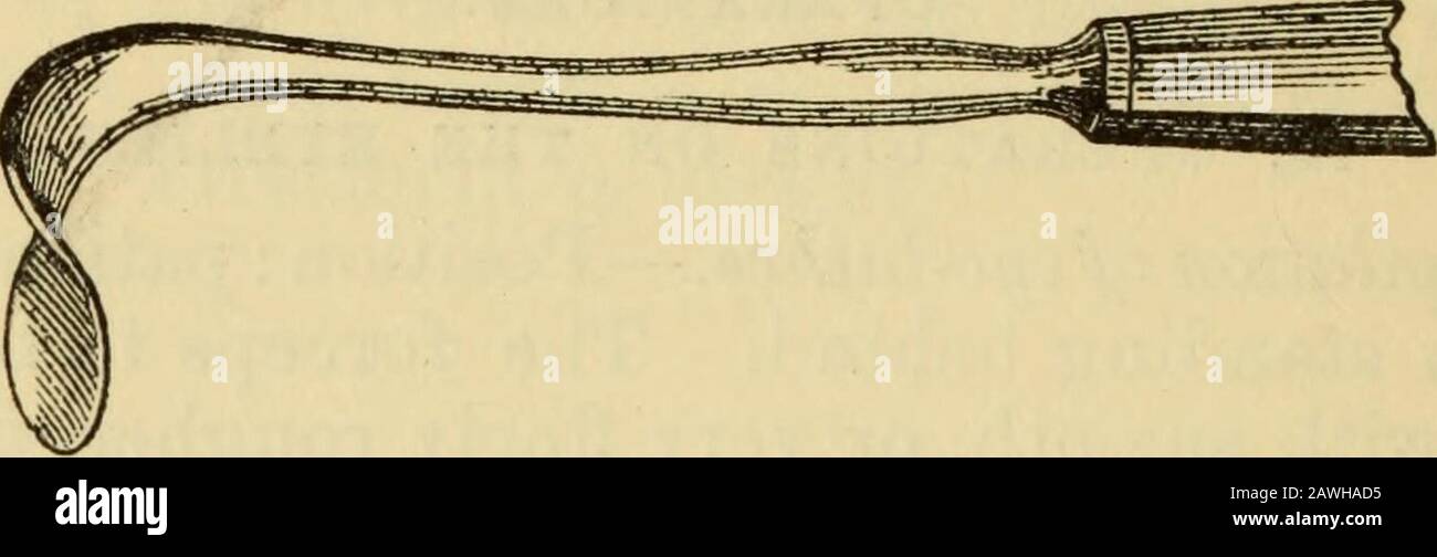 Meibomian cyst hi-res stock photography and images - Alamy