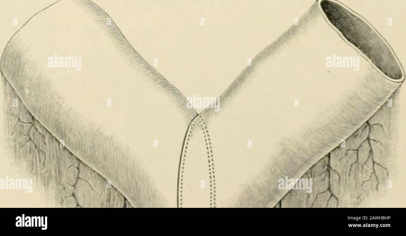 Operative surgery . danger from contamination and of annoyance from ...