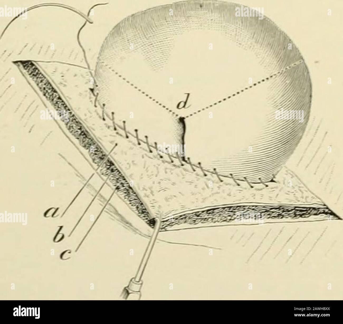 Bookidoperativesurgery02brya hi-res stock photography and images - Alamy