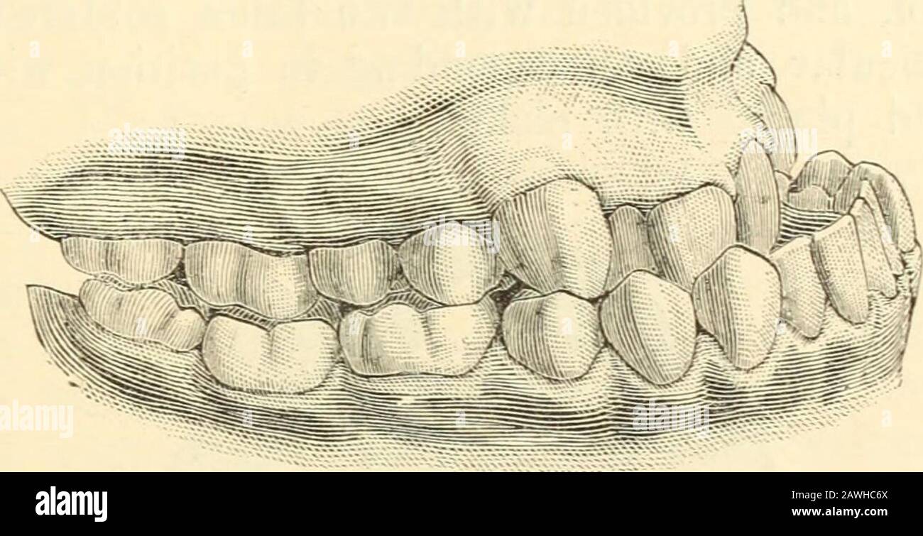 Labial form hi-res stock photography and images - Alamy