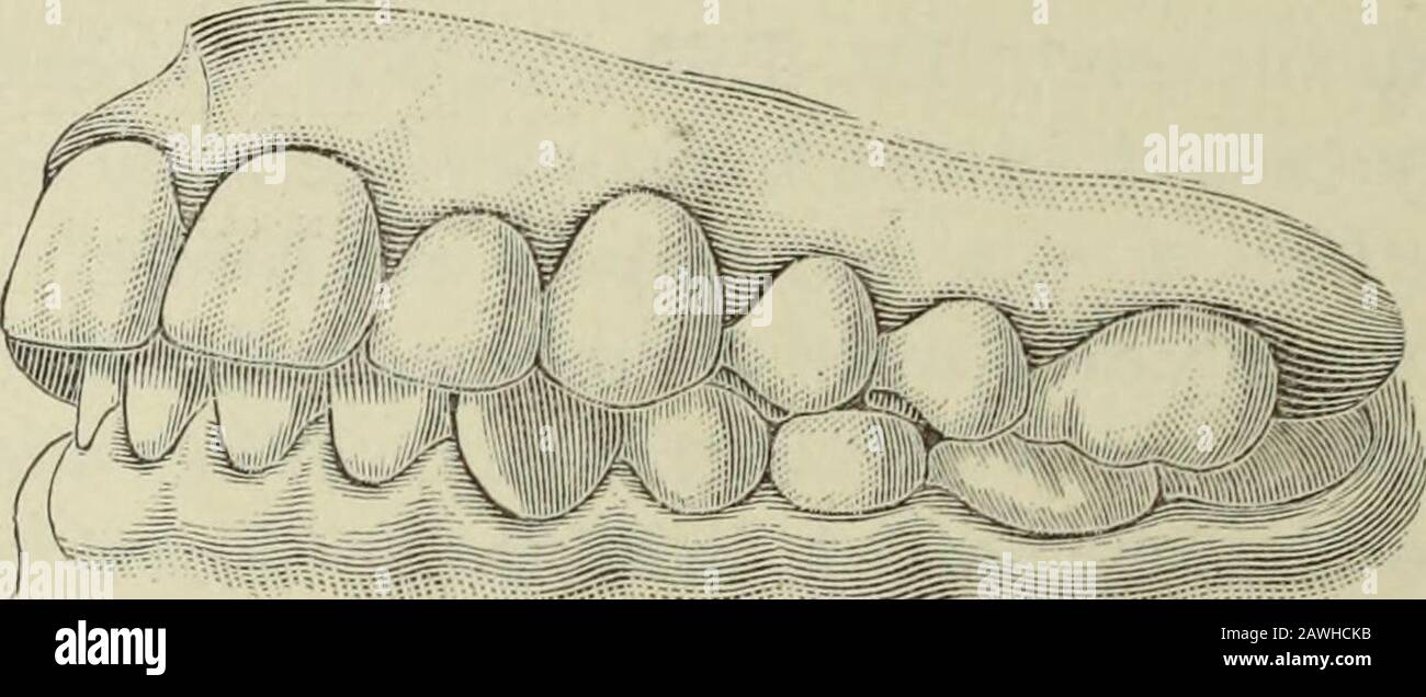 The Dental cosmos . 204 THE DENTAL COSMOS. expected to change the shape ...
