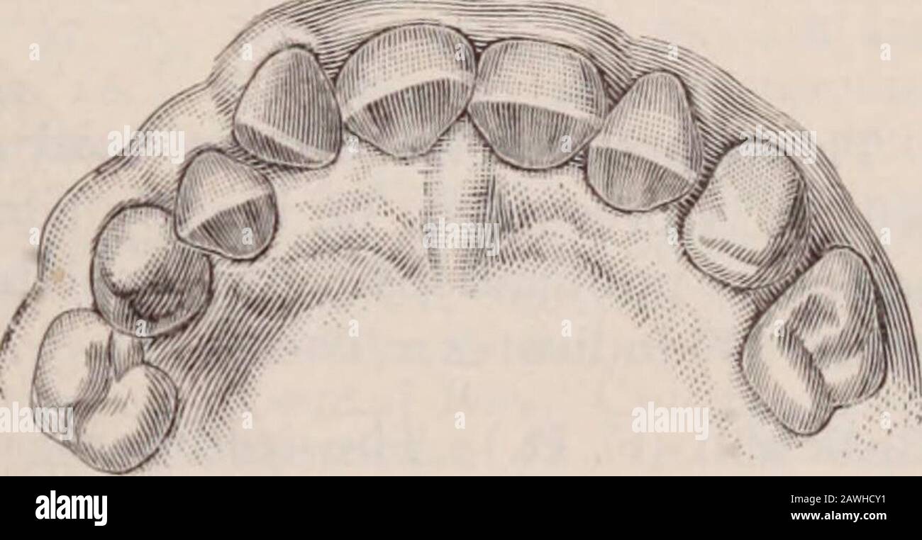 Apical foramen of root of tooth hi-res stock photography and images - Alamy