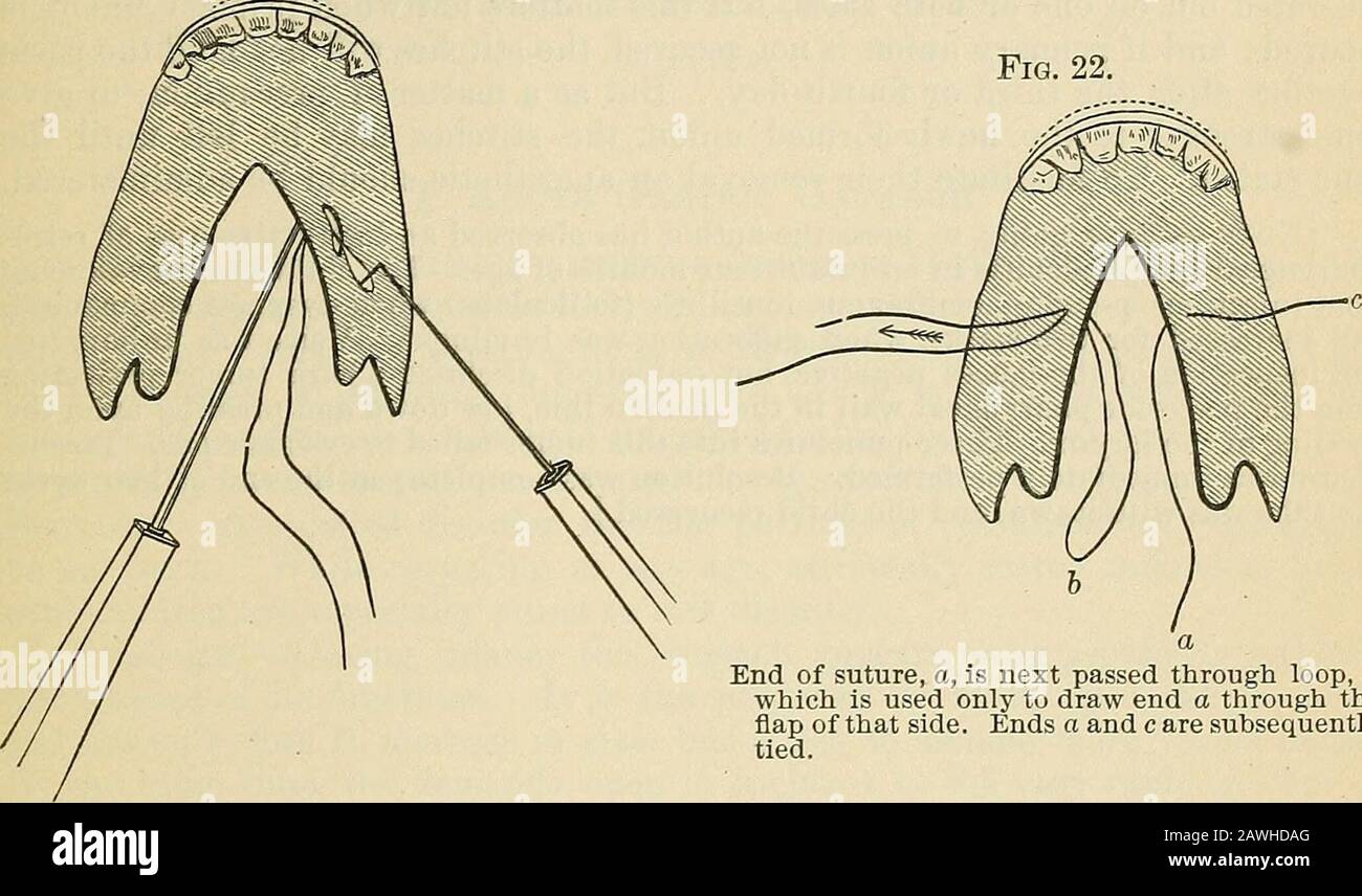 Flap closing hi-res stock photography and images - Alamy