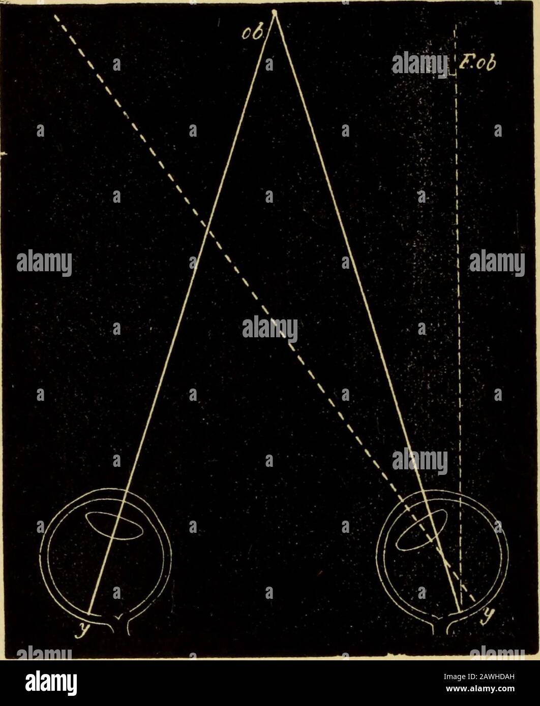 Diplopia High Resolution Stock Photography and Images - Alamy