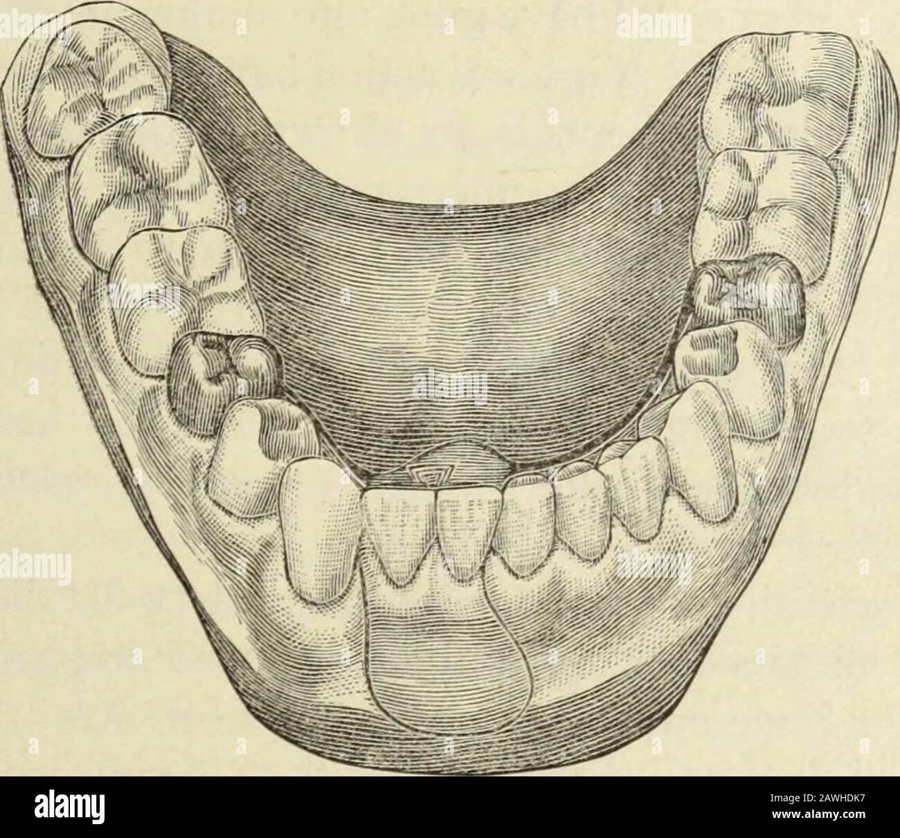 Three inward bent hi-res stock photography and images - Alamy