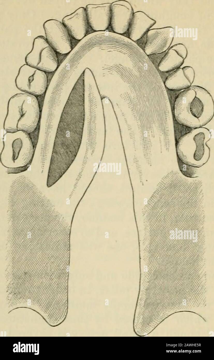 Throat flap hi-res stock photography and images - Alamy