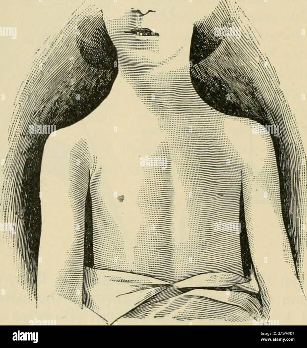 Barrel shaped chest hi-res stock photography and images - Alamy