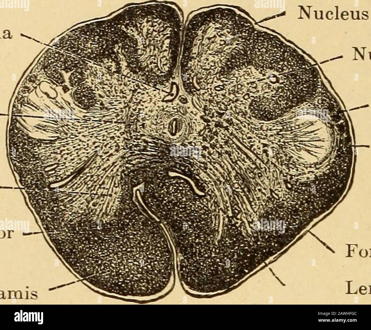 Diseases of the nervous system .. . Nucleus funiculi gracilisNucleus ...