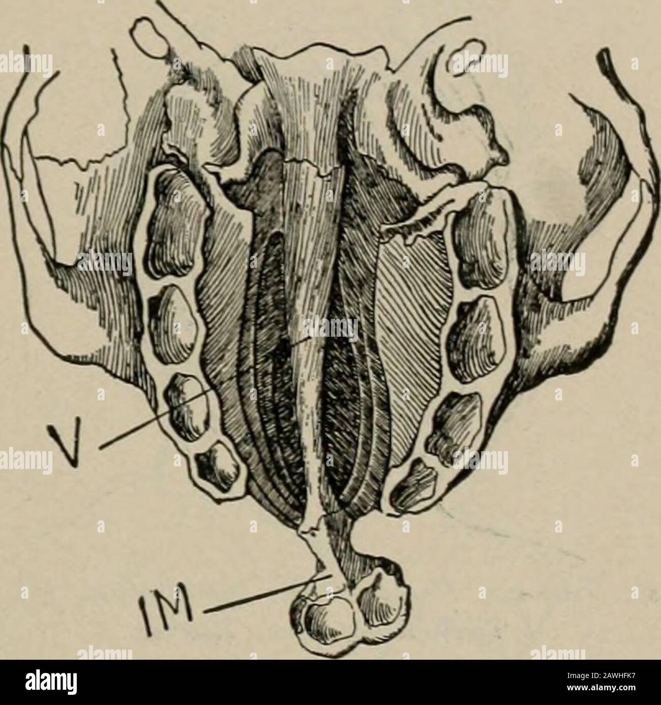 Congenital deformities hi-res stock photography and images - Alamy