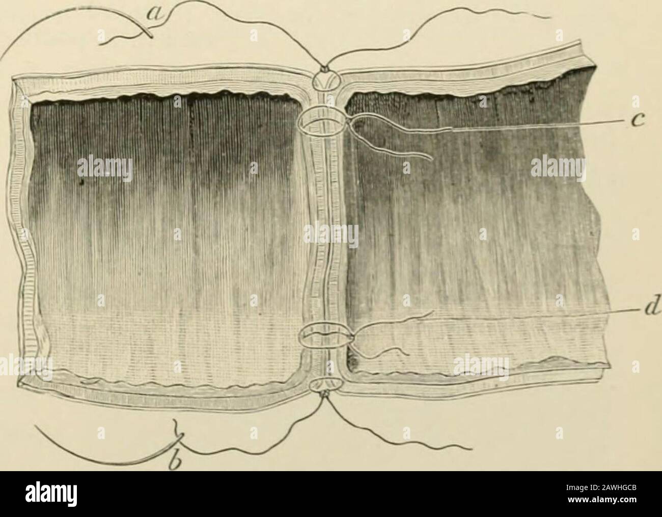 Operative surgery . Fig. 871.— Resection of intestine, Kocliers method ...